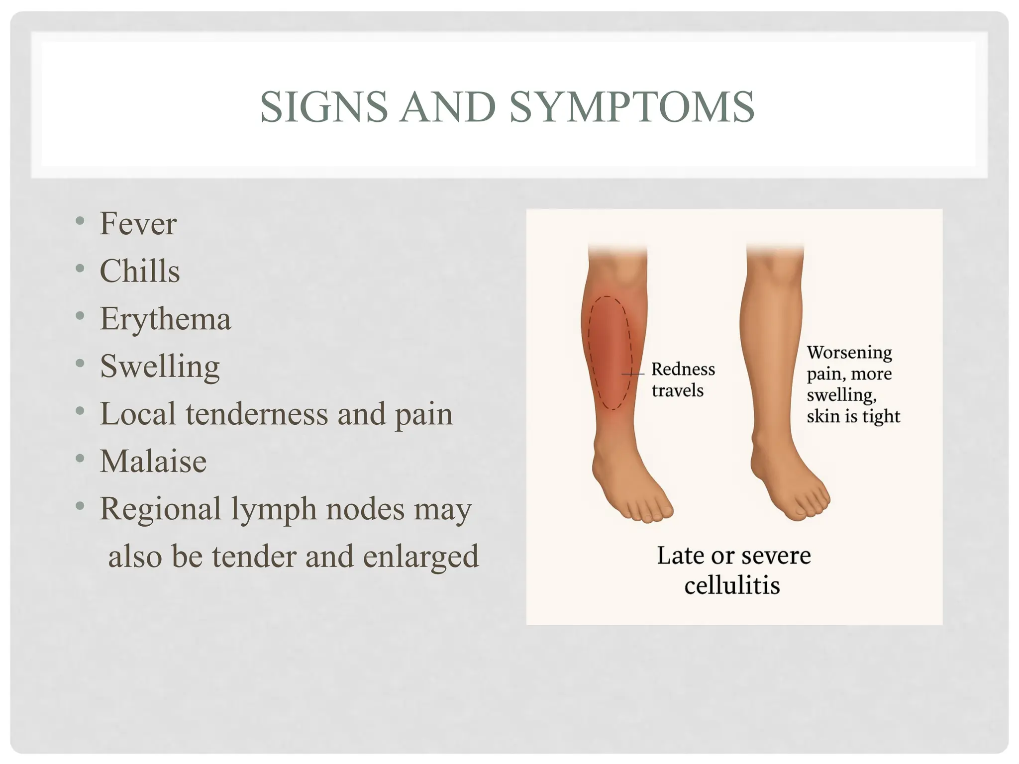 Understanding Cellulitis: Causes, Symptoms, and Treatment Approaches | PPTX