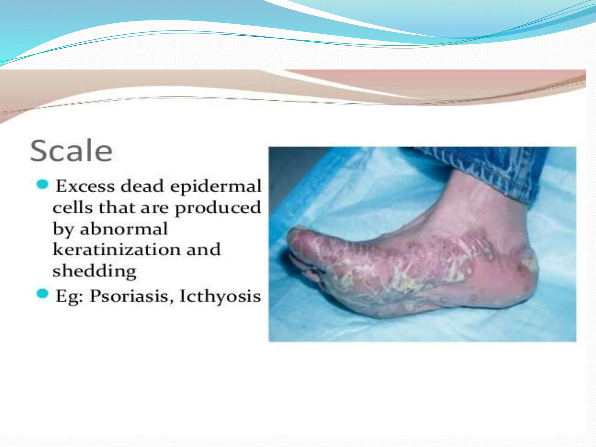 CELLULITIS superficial bacterial infection.pptx
