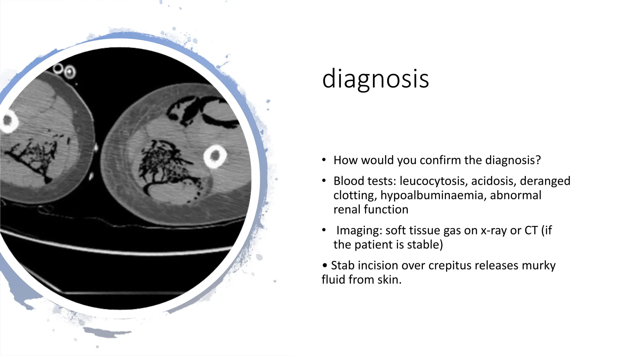 cellulitis and burn.pptx