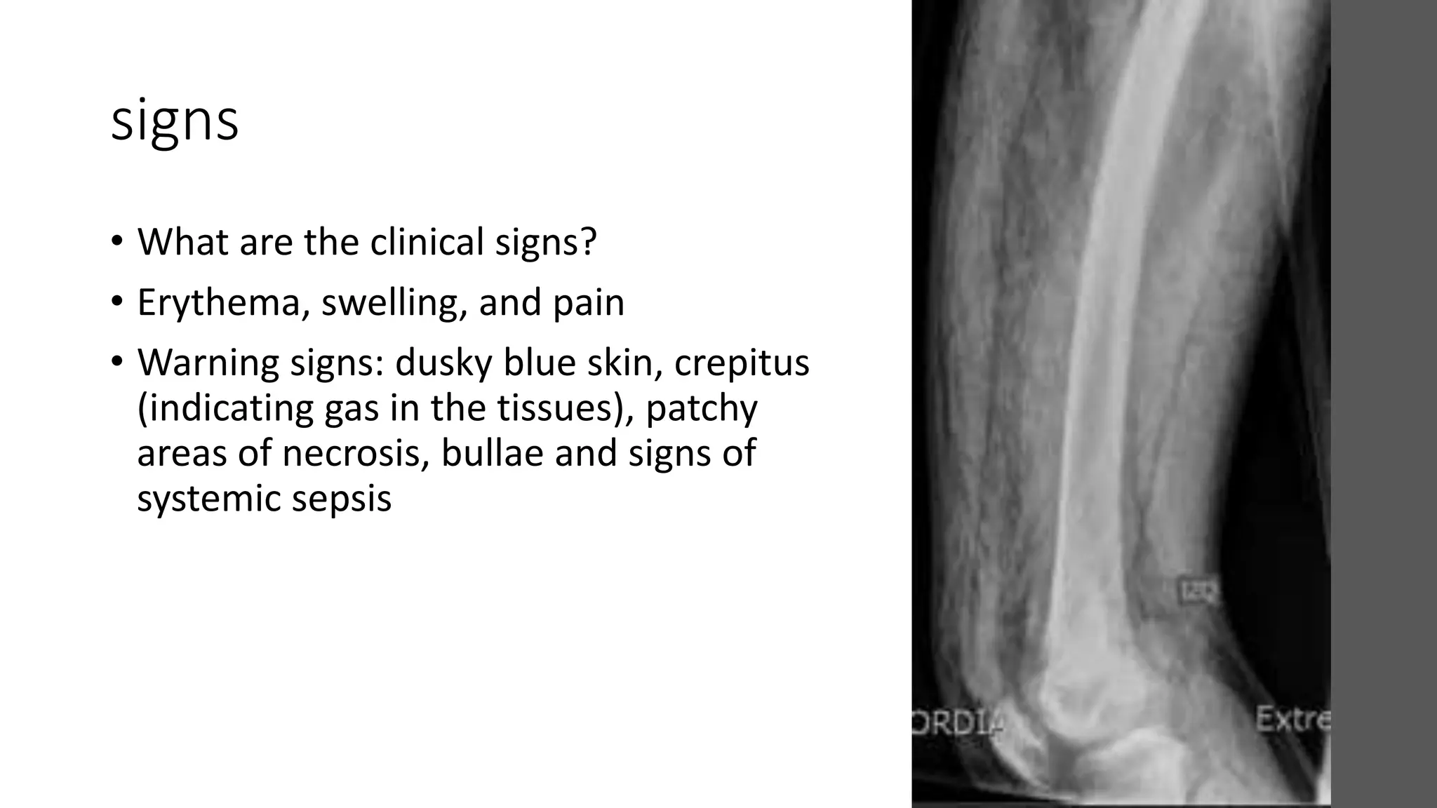 cellulitis and burn.pptx