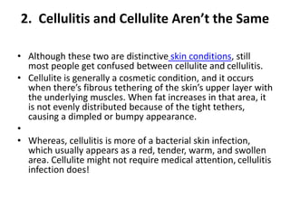 cellulitis causes,symptoms and treatment at safe health center in Mt Pleasant, MI.pptx