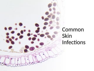 Common Skin Infections for Medical Students | PPTX