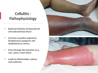 Common Skin Infections for Medical Students | PPTX