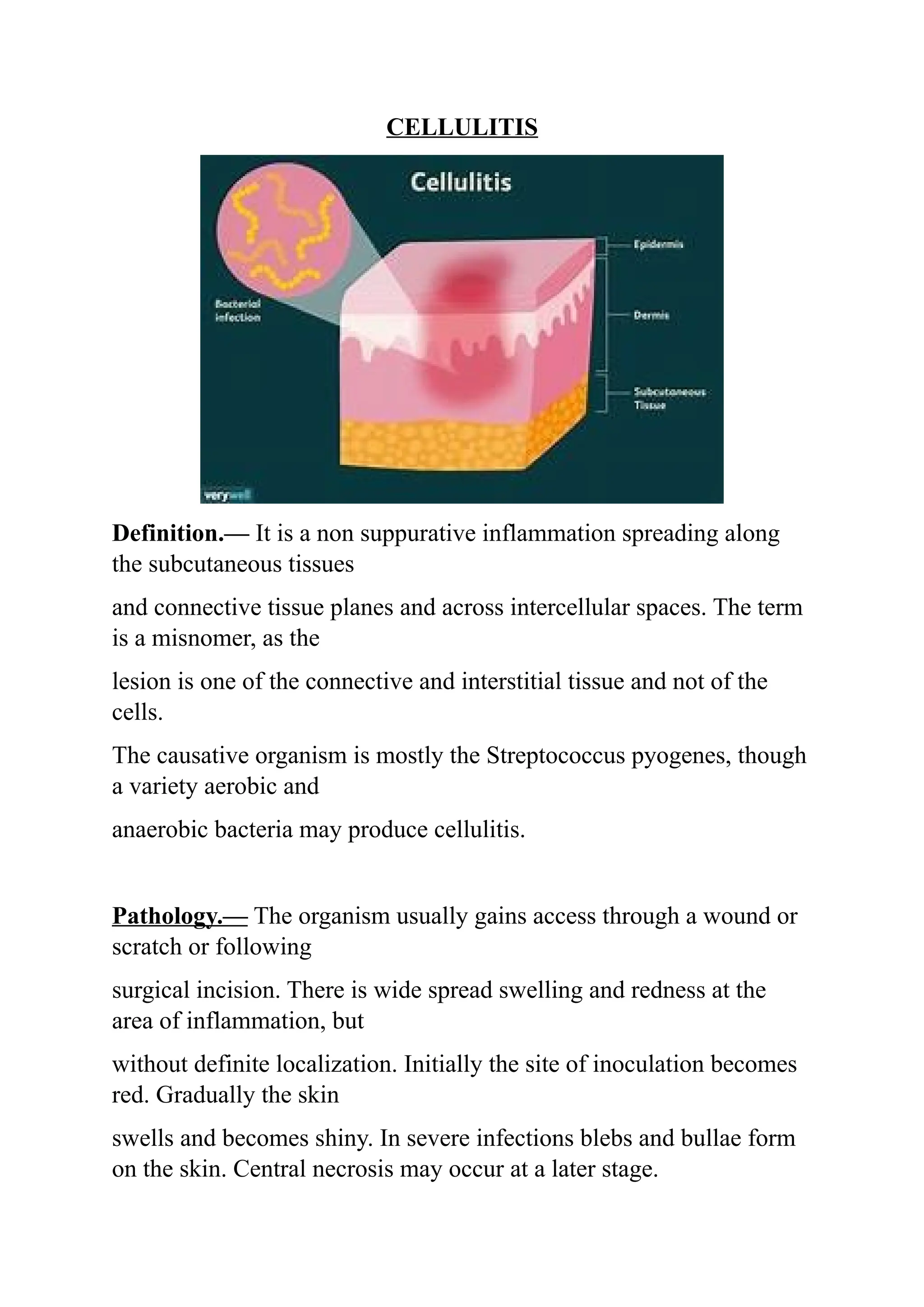 cellulitis , ulcers -general surgery.docx