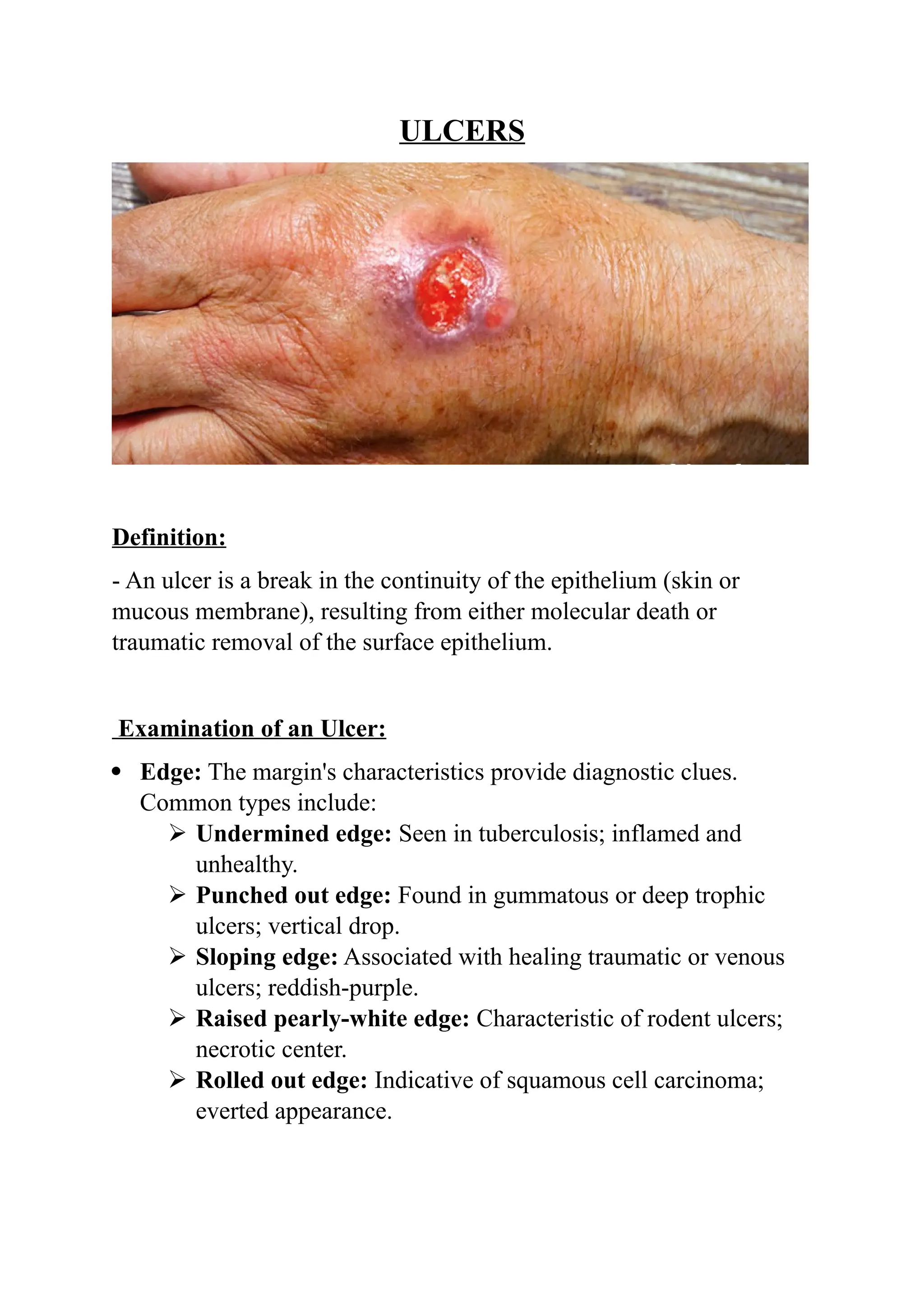 cellulitis , ulcers -general surgery.docx