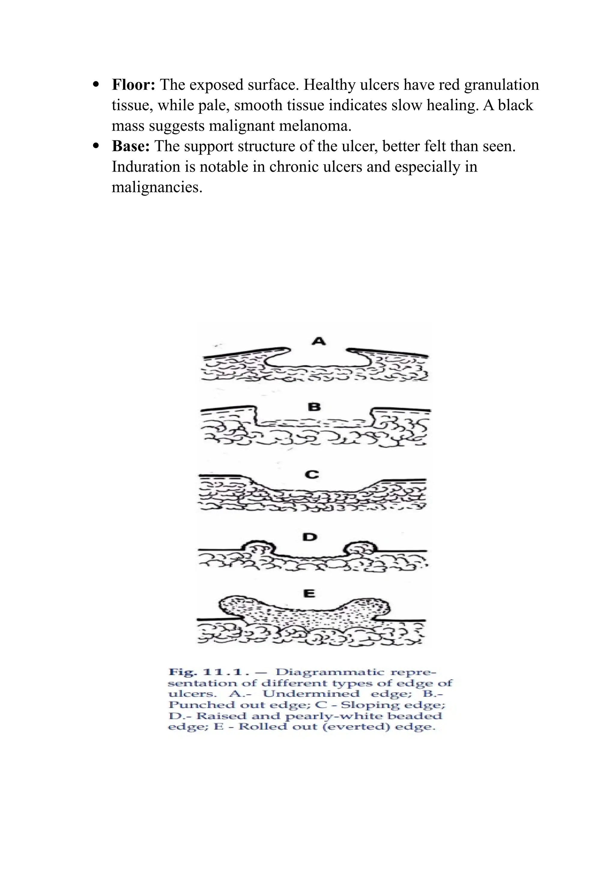 cellulitis , ulcers -general surgery.docx