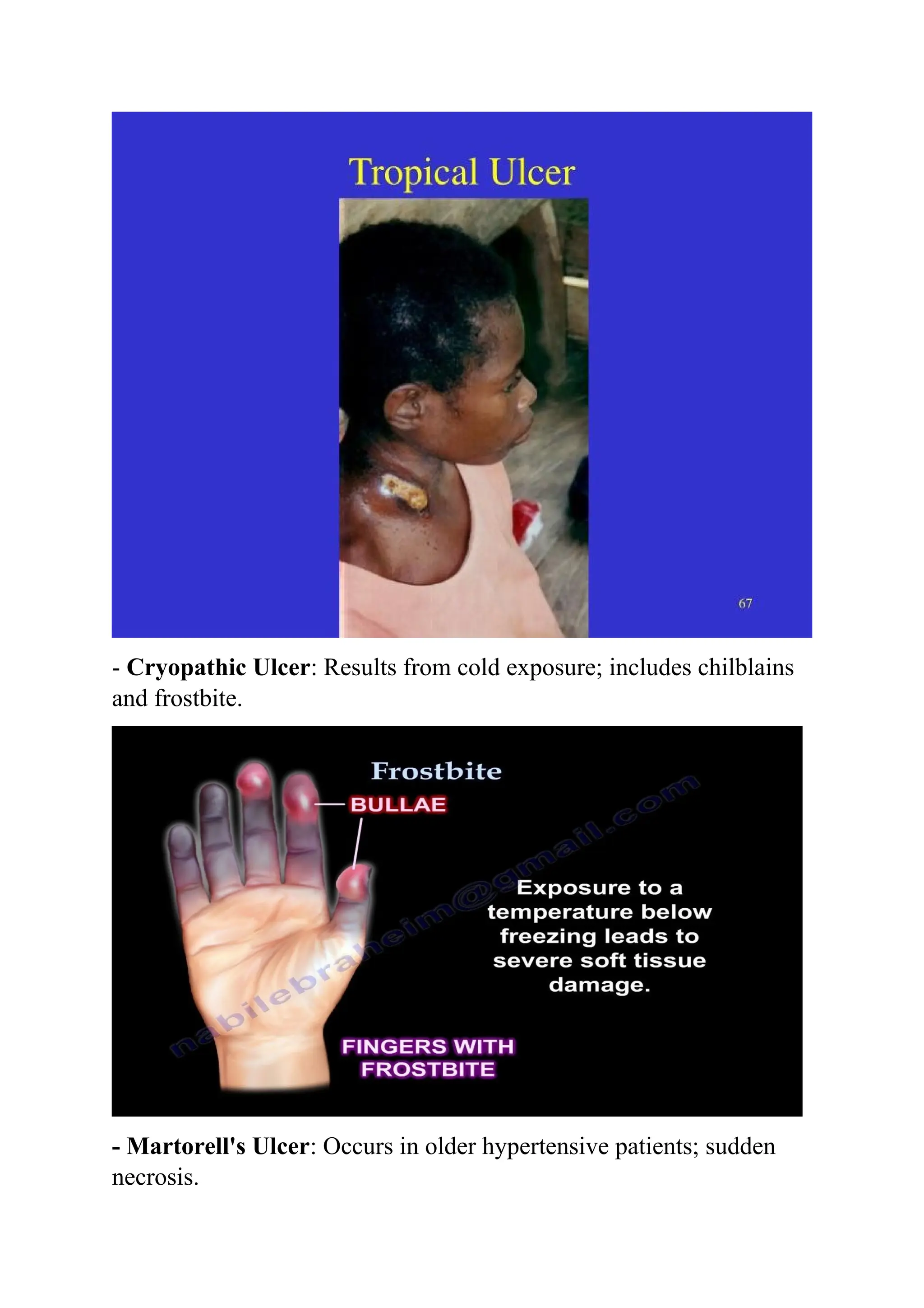 cellulitis , ulcers -general surgery.docx