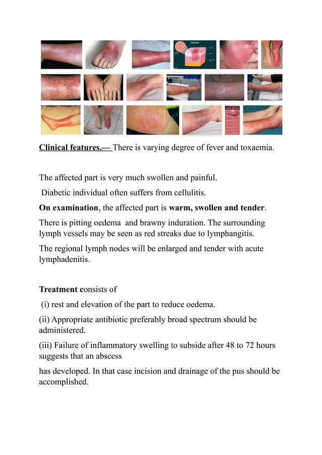 cellulitis , ulcers -general surgery.docx