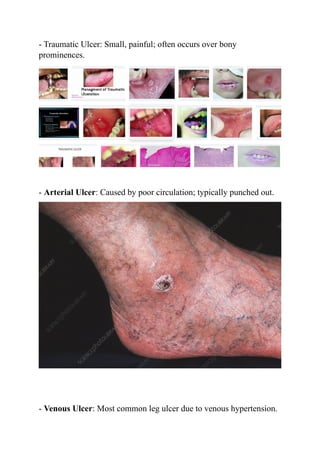 cellulitis , ulcers -general surgery.docx