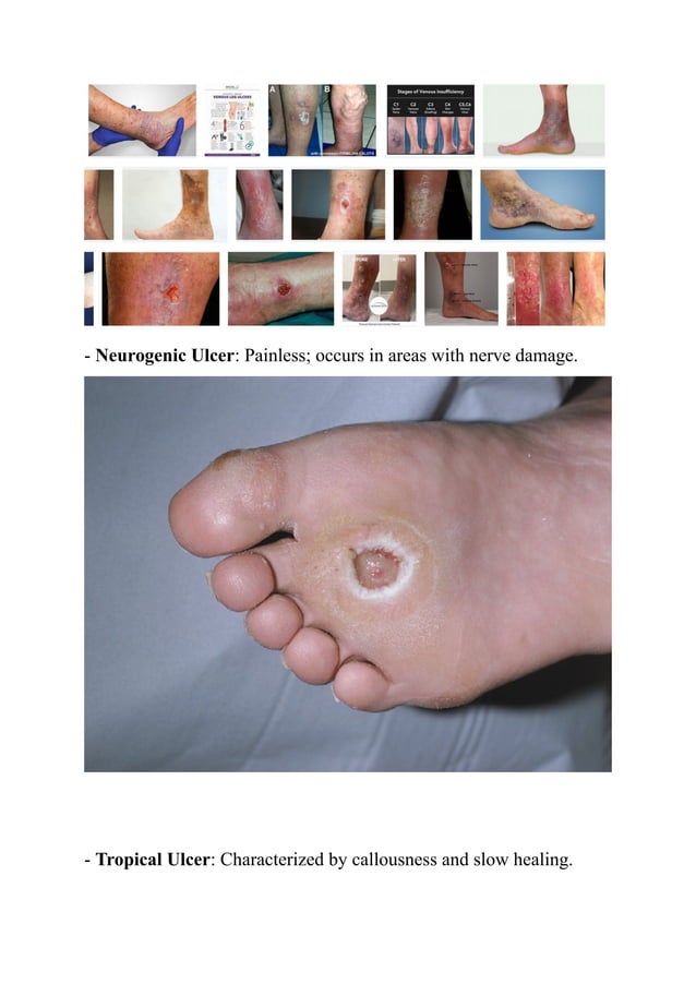cellulitis , ulcers -general surgery.docx