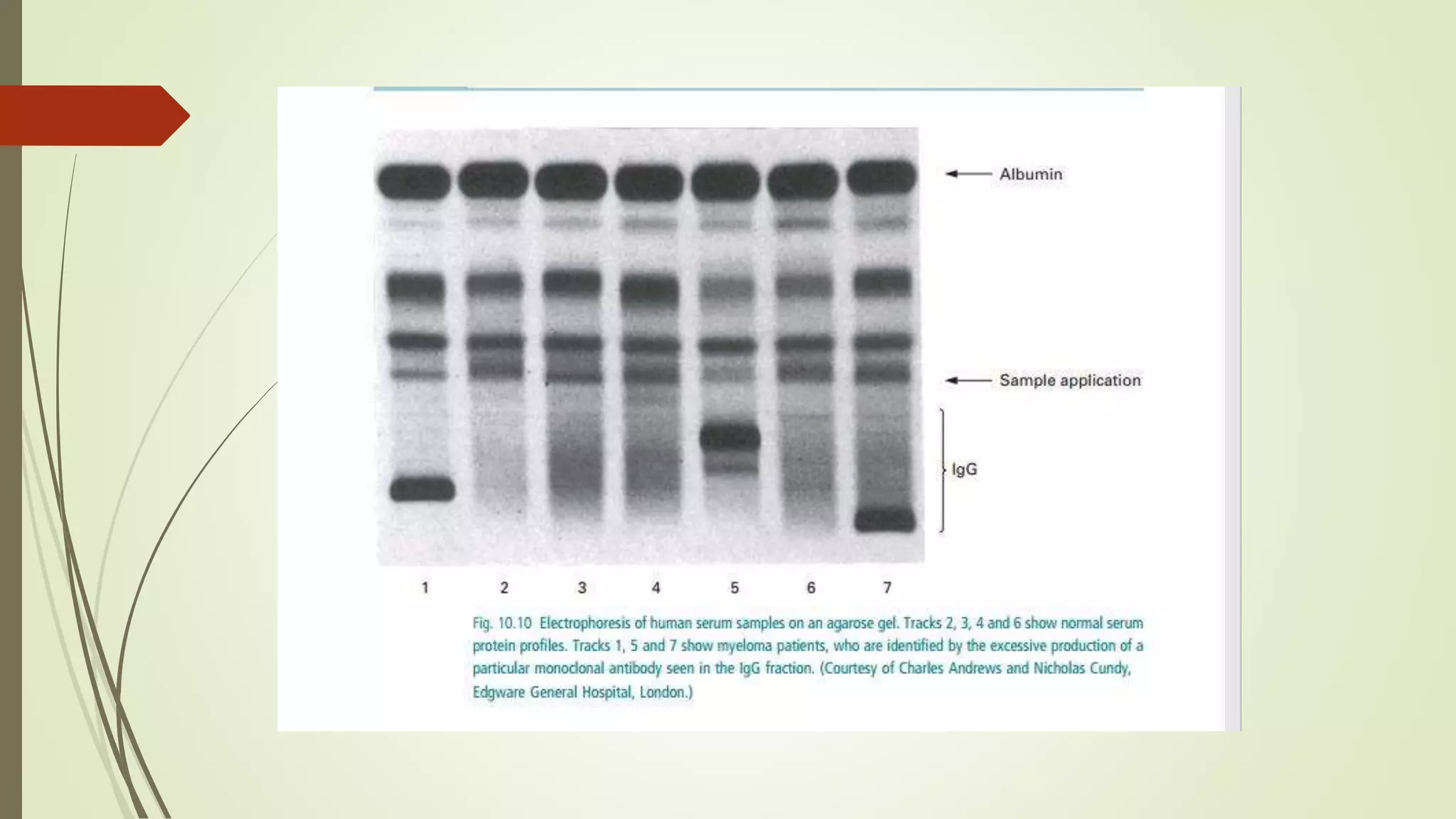 Cellulose acetate electrophoresis | PPTX