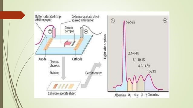 Cellulose acetate electrophoresis