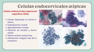 Celulas glandulares atipicas-Harold Prosopio Inga.pdf