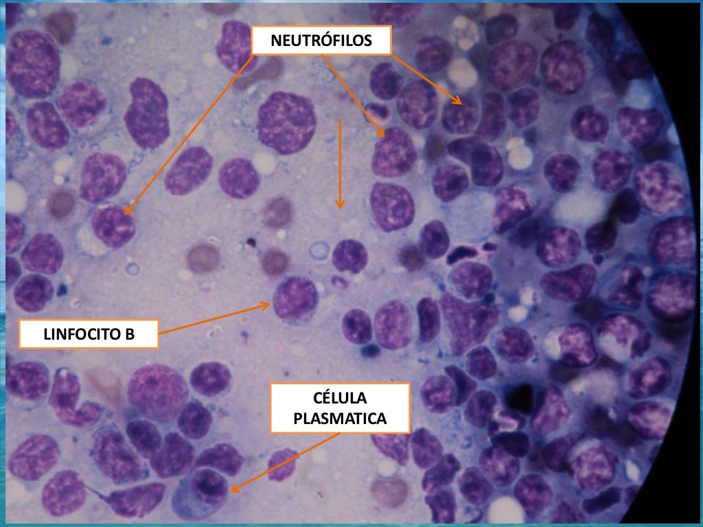 Celulas Linfoideas