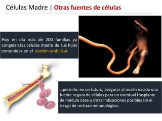 Células Madre [Stem Cells] | PPTX