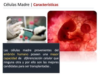 Células Madre [Stem Cells] | PPTX