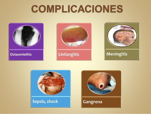 Qu Es La Celulitis Infecciosa Y Cmo Identificar