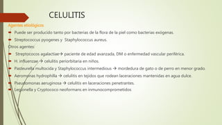 Celulitis | PPTX