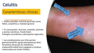 DIAPOSITIVAS SOBRE CELULITIS APOYO MEDICO.pptx