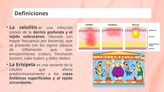 celulitiscuadroclinico y tratamiento.pptx