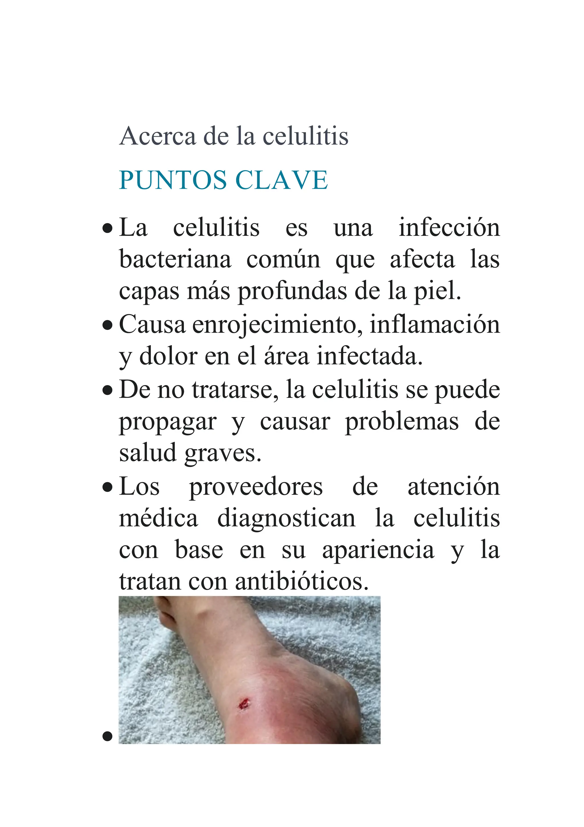 Celulitis: Diferencias entre la infección bacteriana y la condición ...