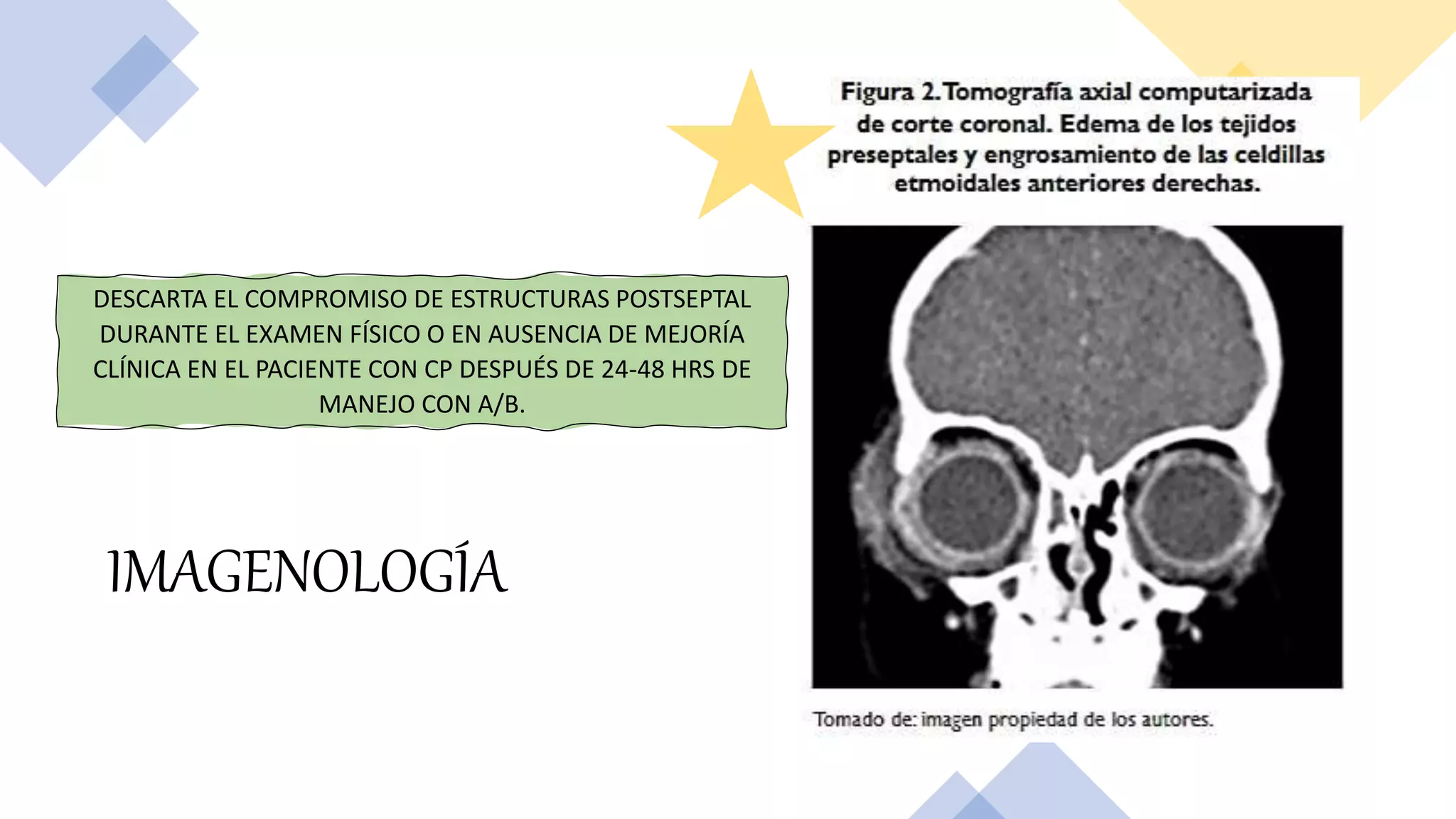 Celulitis preseptal y orbitaria | PPTX