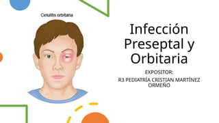 celulitis preseptal y postseptal en pediatria | PPTX