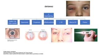 celulitis preseptal y postseptal en pediatria | PPTX