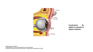 celulitis preseptal y postseptal en pediatria | PPTX