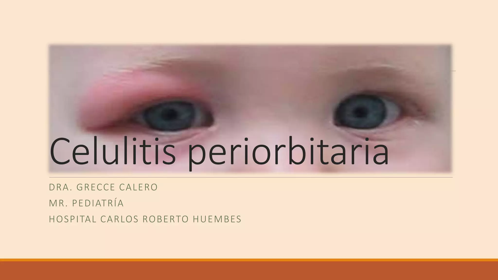 Celulitis periorbitaria | PPTX