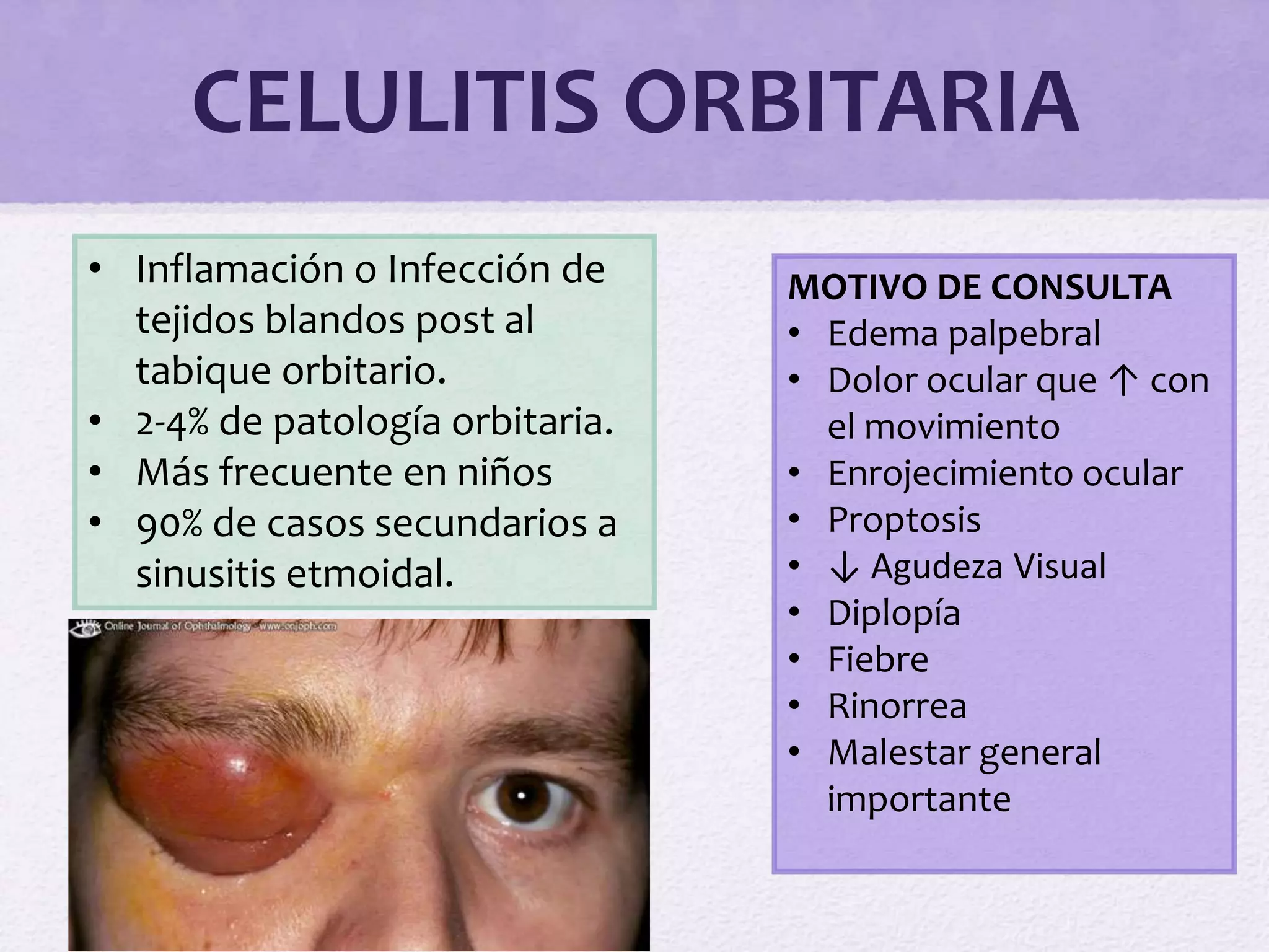 Celulitis periorbitaria y orbitaria | PPTX