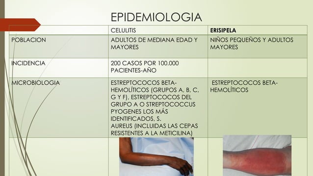 1234566788yteyCELULITIS Y ERISIPELA.pptx
