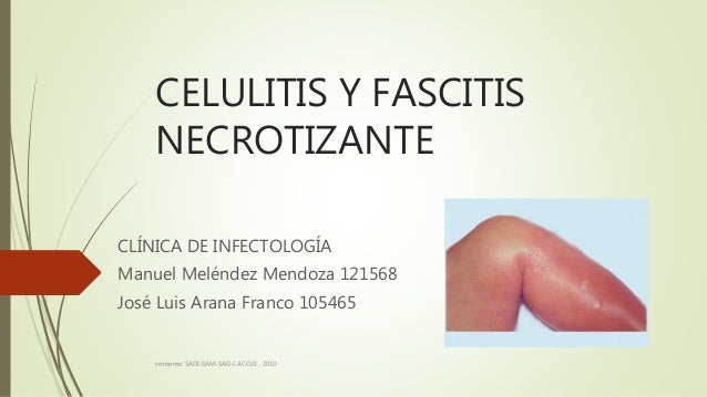 Celulitis. Clínica Y Tratamiento – FIHIDU