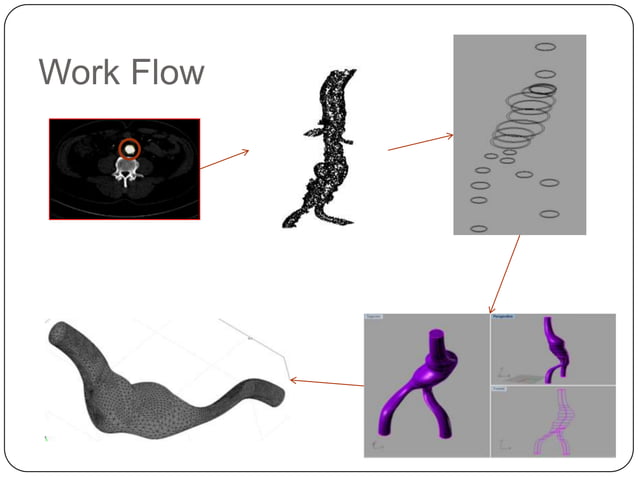 FEM CFD Aneurism Analysis | PPT