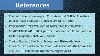 Treatment outcome of the Teeth with Cemental Tears -DR.ANUBHUTI | PPTX
