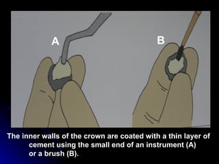 Cementation | PPT