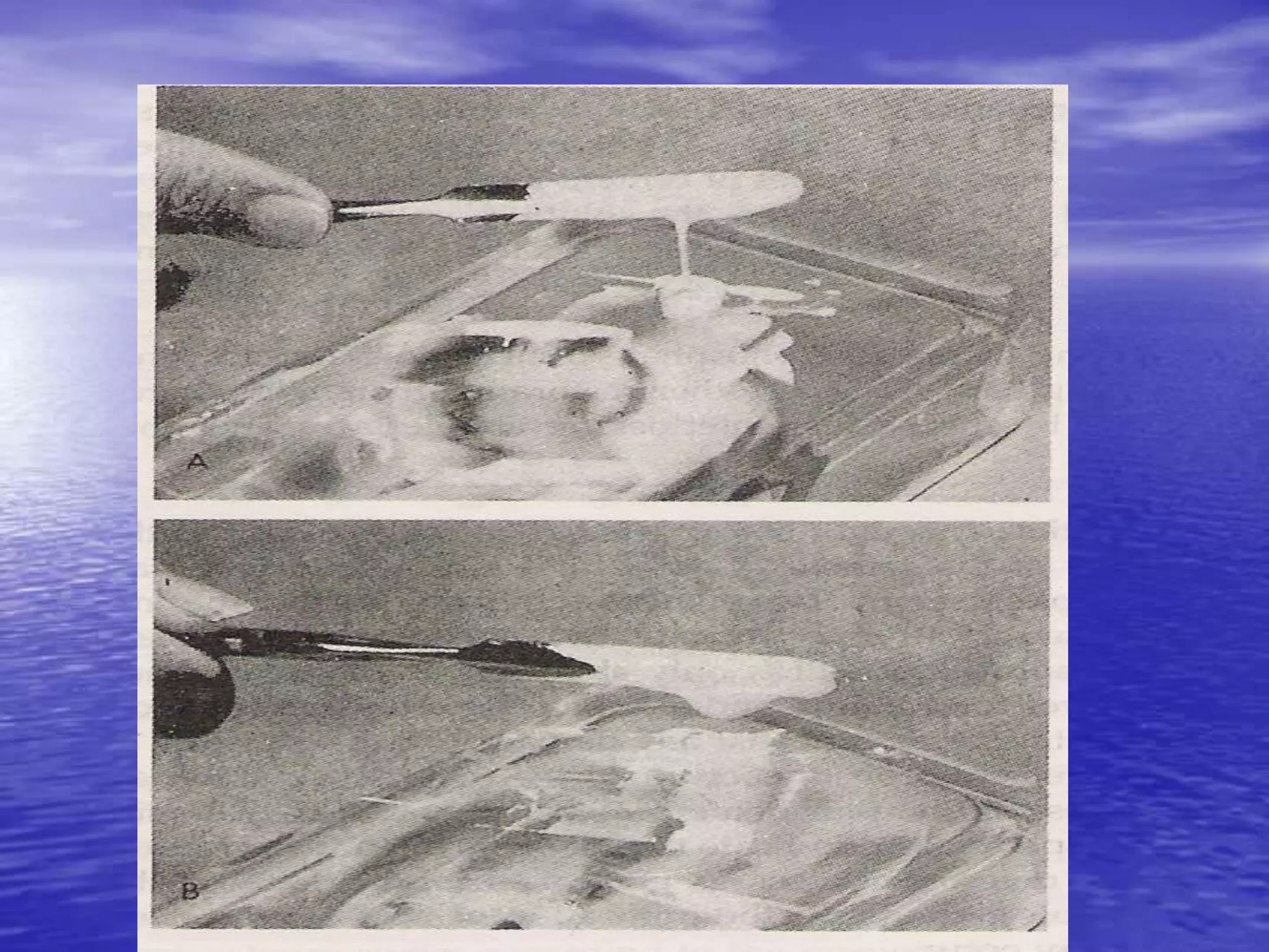 Cementation procedures in fpd | PPT