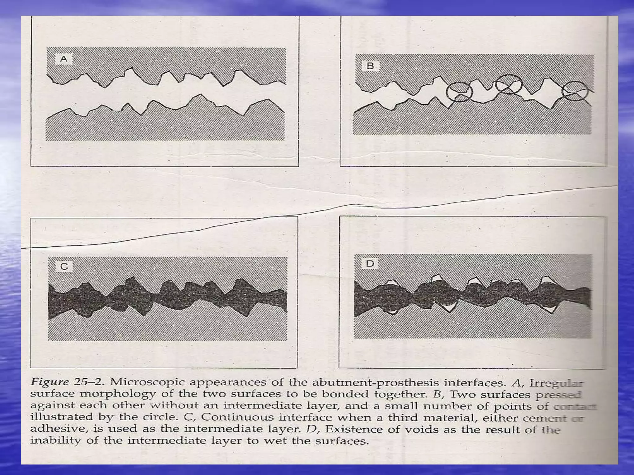 Cementation procedures in fpd | PPT