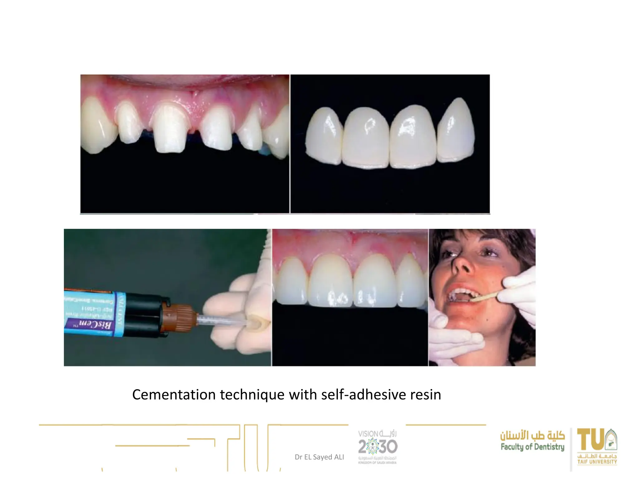 Luting agent and cementation processTaif.pdf