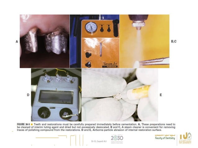 Luting agent and cementation processTaif.pdf