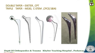 Cemented vs uncemented total hip arthroplasty | PDF
