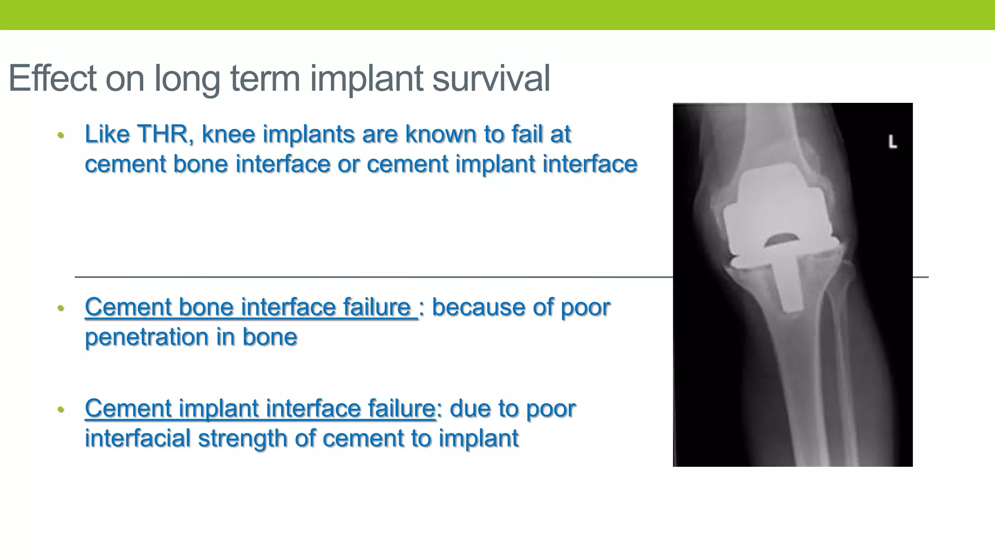 CEMENTING IN TOTAL KNEE REPLACEMENT SURGERY | PPTX