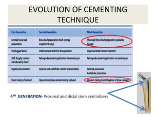 Bone cement,Cementing Generations, Complications & Recent advances | PPTX