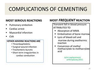 Bone cement,Cementing Generations, Complications & Recent advances | PPTX