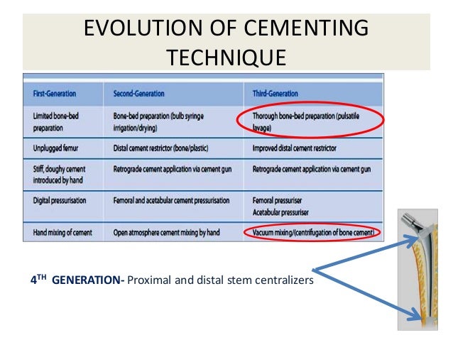 Bone cement,Cementing Generations, Complications & Recent advances