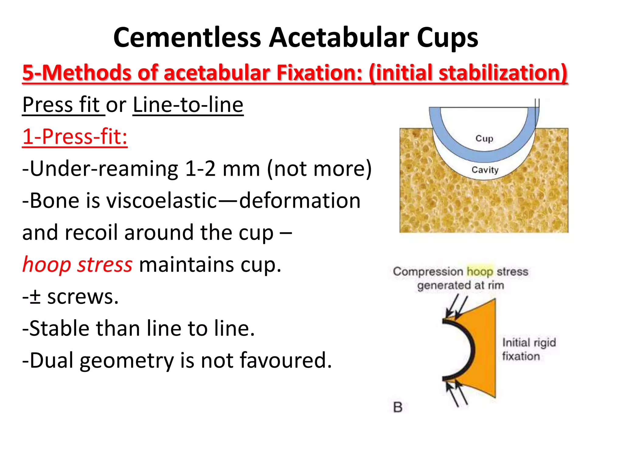 Cementless acetabular cups | PPTX