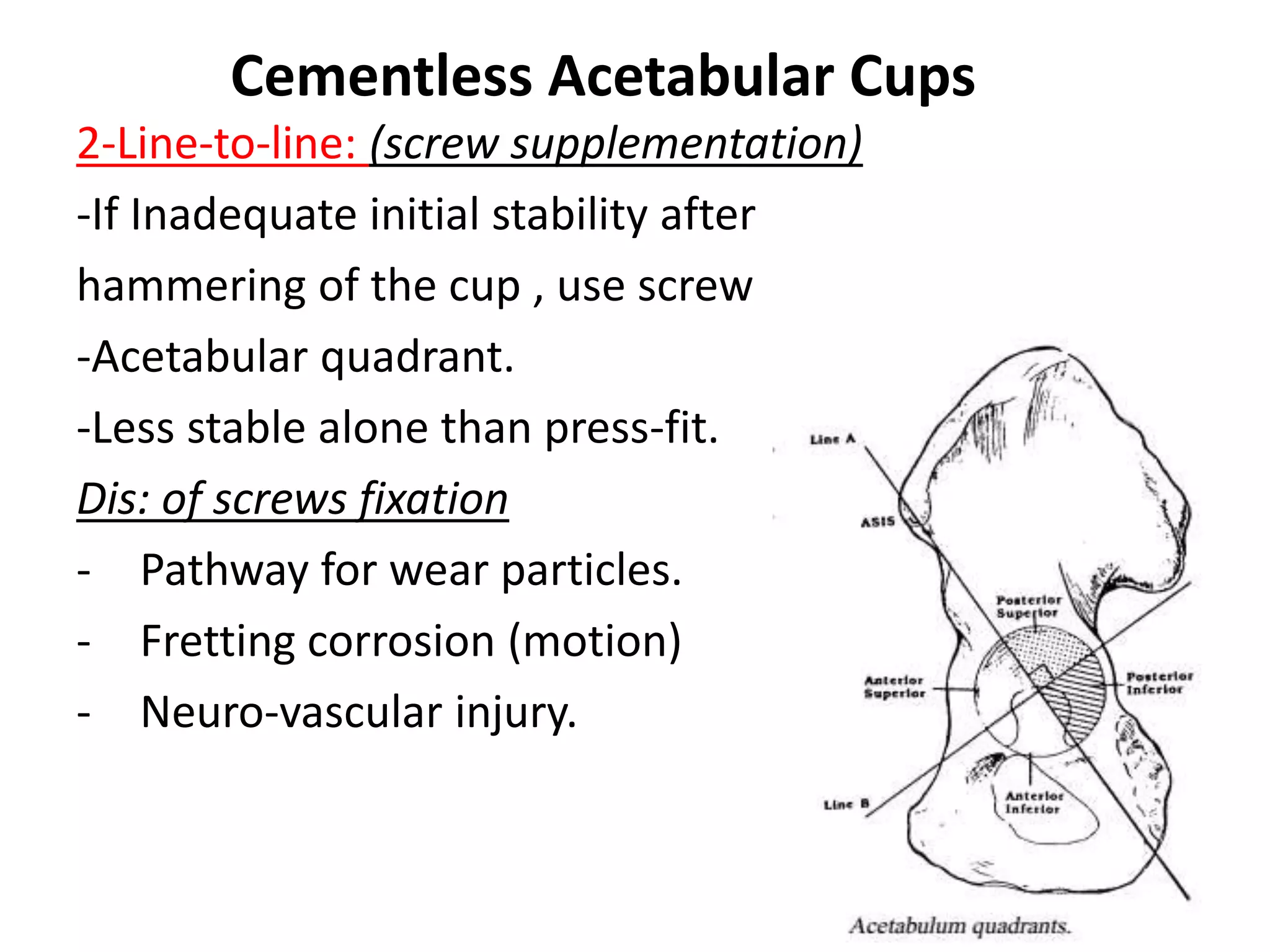 Cementless acetabular cups | PPTX