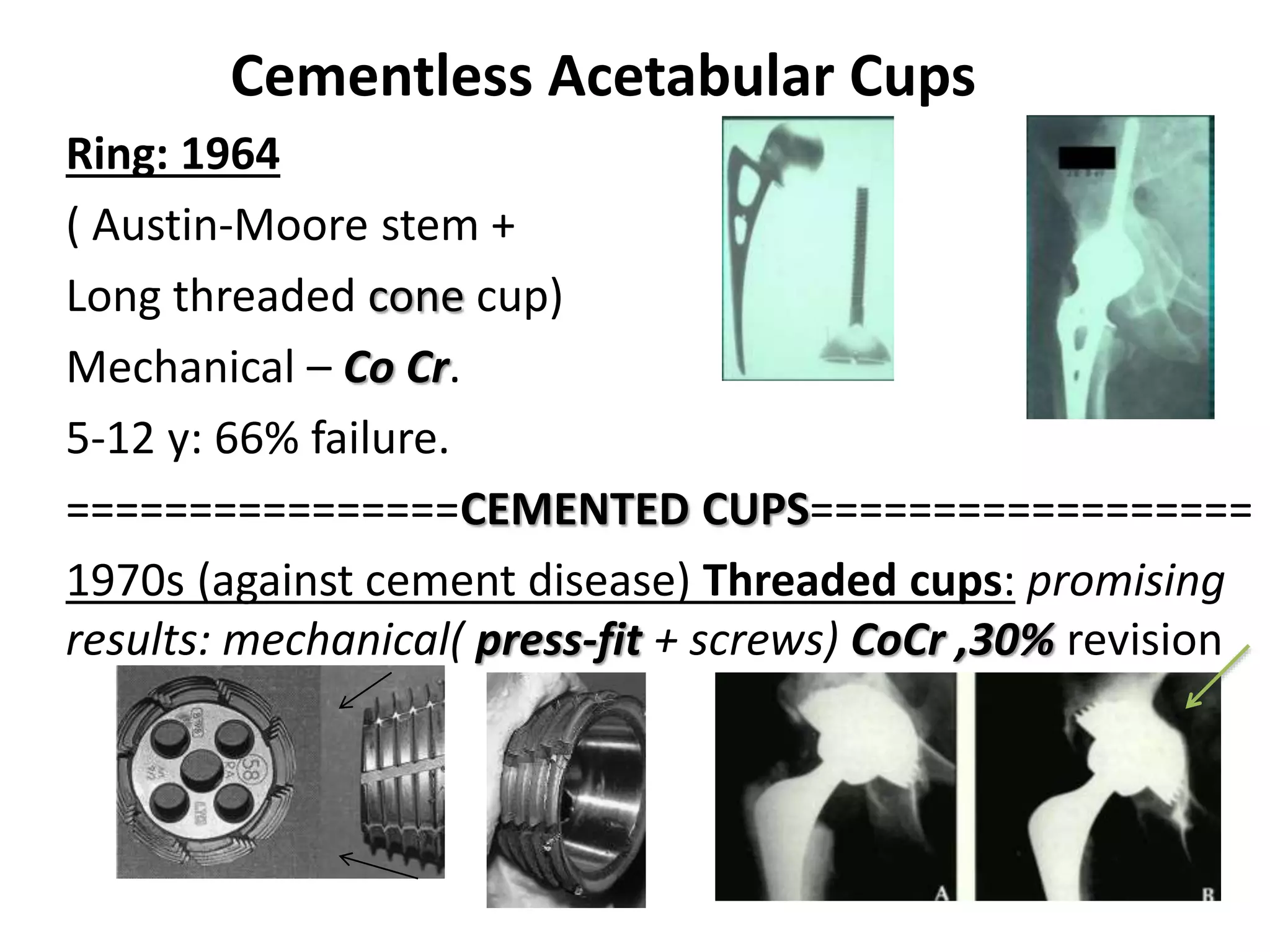 Cementless acetabular cups | PPT