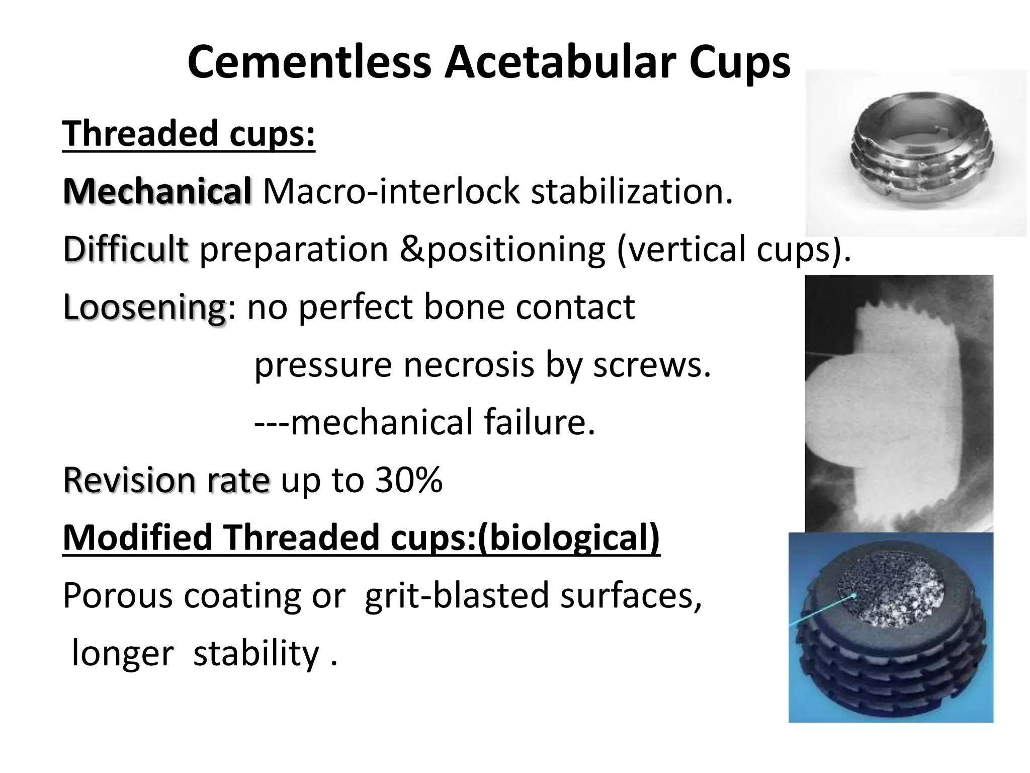 Cementless acetabular cups | PPTX | Bone and Joint Conditions ...