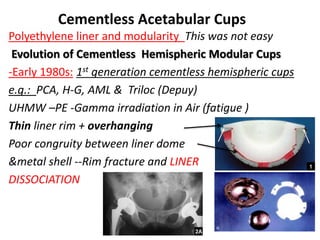 Cementless acetabular cups | PPTX